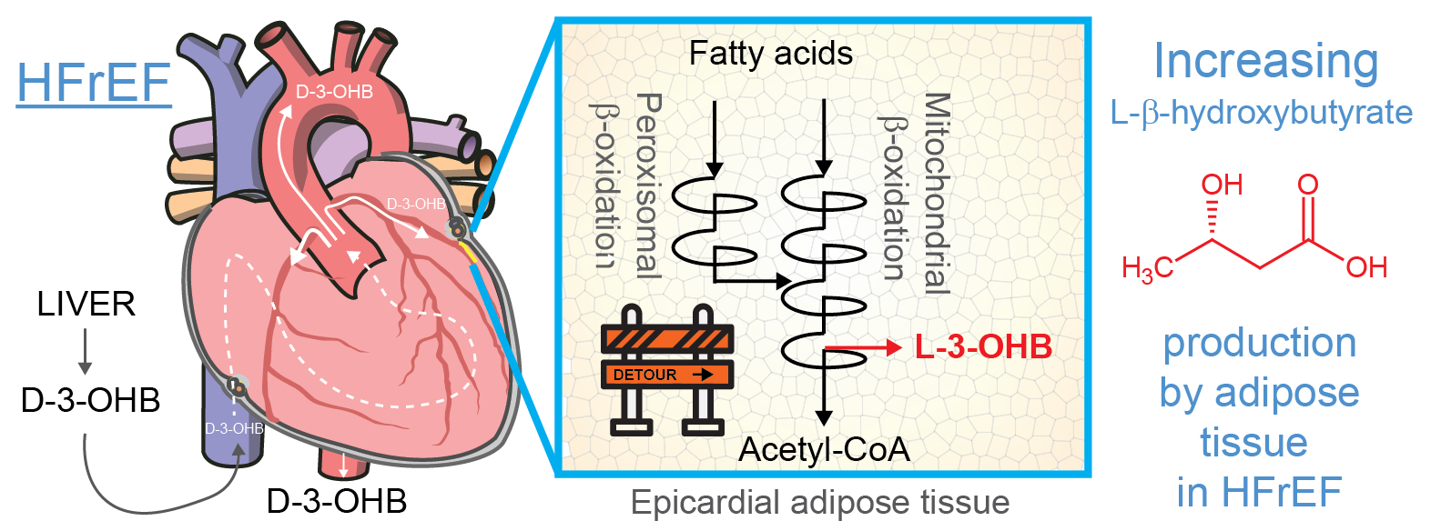 Tuk na povrchu srdce jako zdroj energie při srdečním selhání - FGU